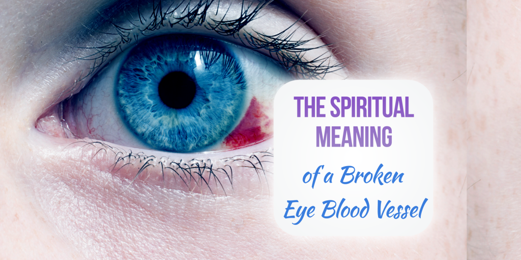 Spiritual Meaning of a Broken Blood Vessel in Your Eye | Simply Symbolism